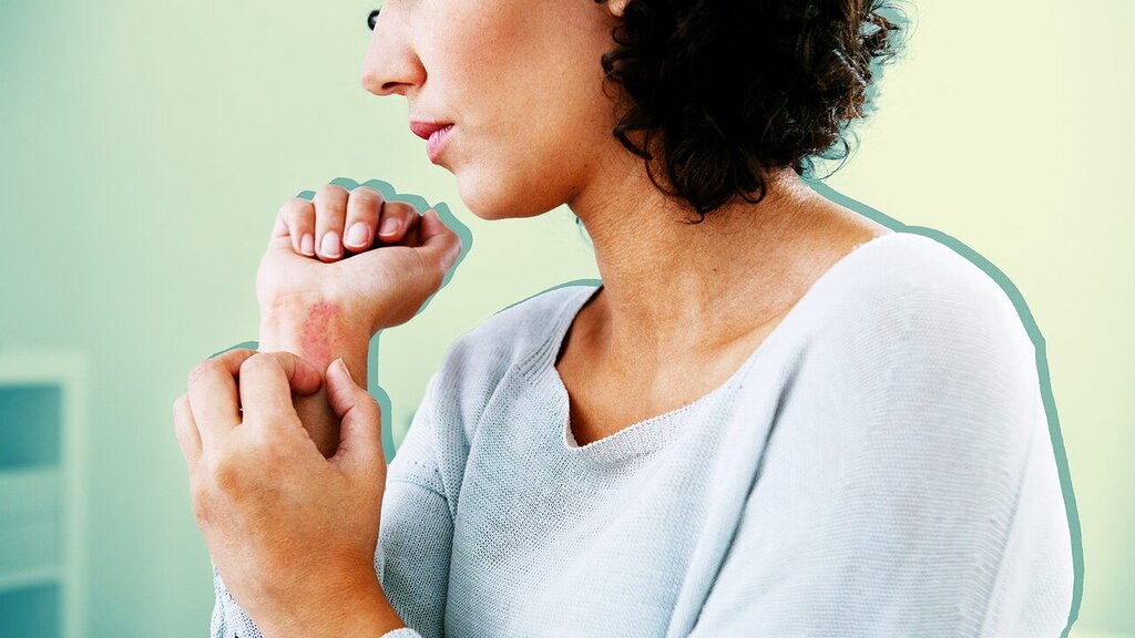 Psoriasis : les traitements efficaces