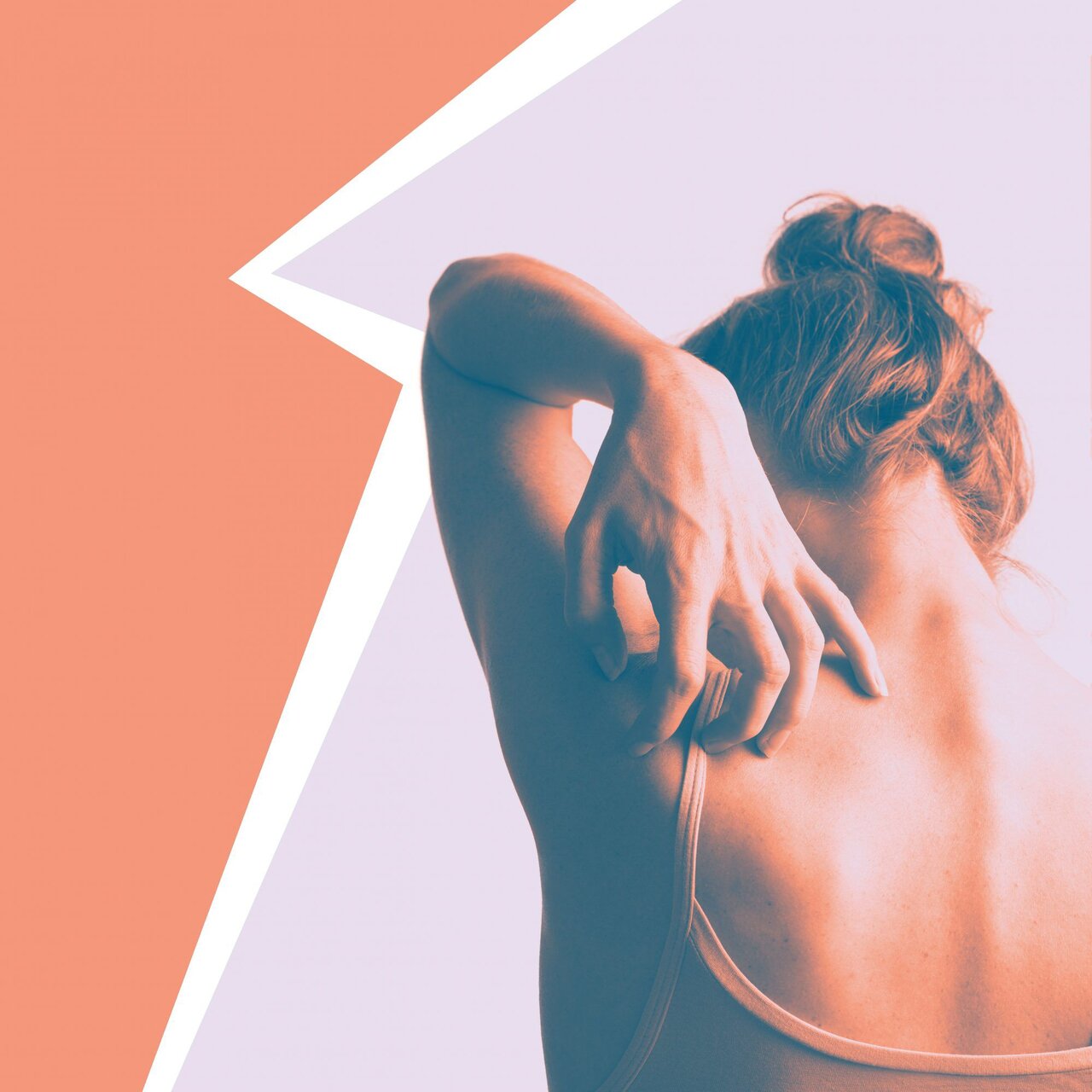 Qu'est-ce que le psoriasis érythrodermique ? Les dermatologues ...